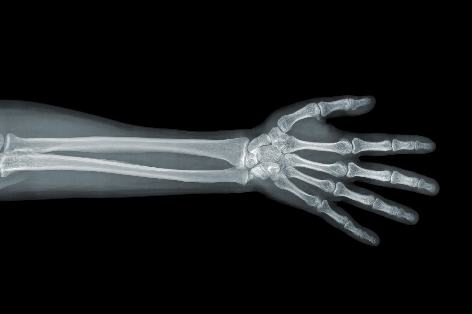 Raggi X per le indagini di polizia